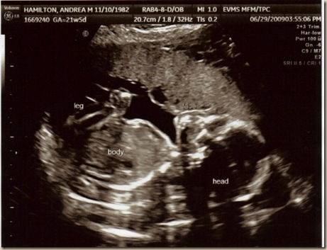 Pregnancy Update & Ultrasound Pics